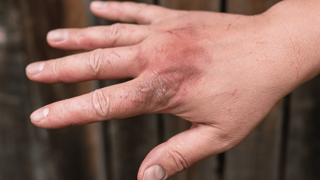 14 Research Topics for Nursing Students