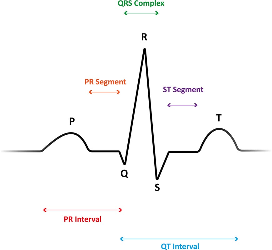 EKG Interpretation for Nurses | NURSING.com