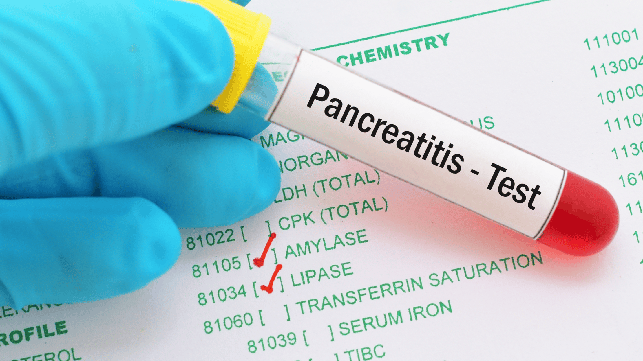Pancreatitis Review for NCLEX Prep and Nursing School | Nursing Case Study