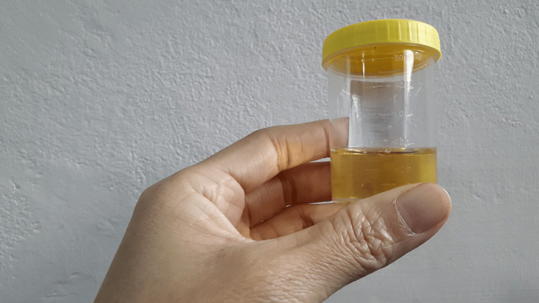 Nurses’ Guide: What Is the Crede Maneuver? | NURSING.com