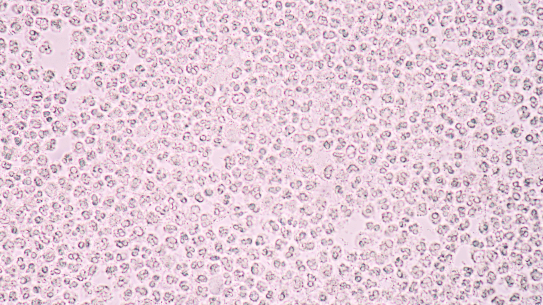 Urinary Tract Infection NCLEX Review for Nursing Students