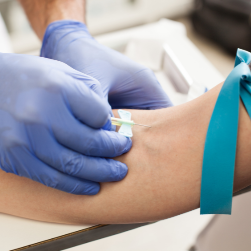 Complete Guide to Blood Urea Nitrogen (BUN) Lab Values: Nursing Lab Values